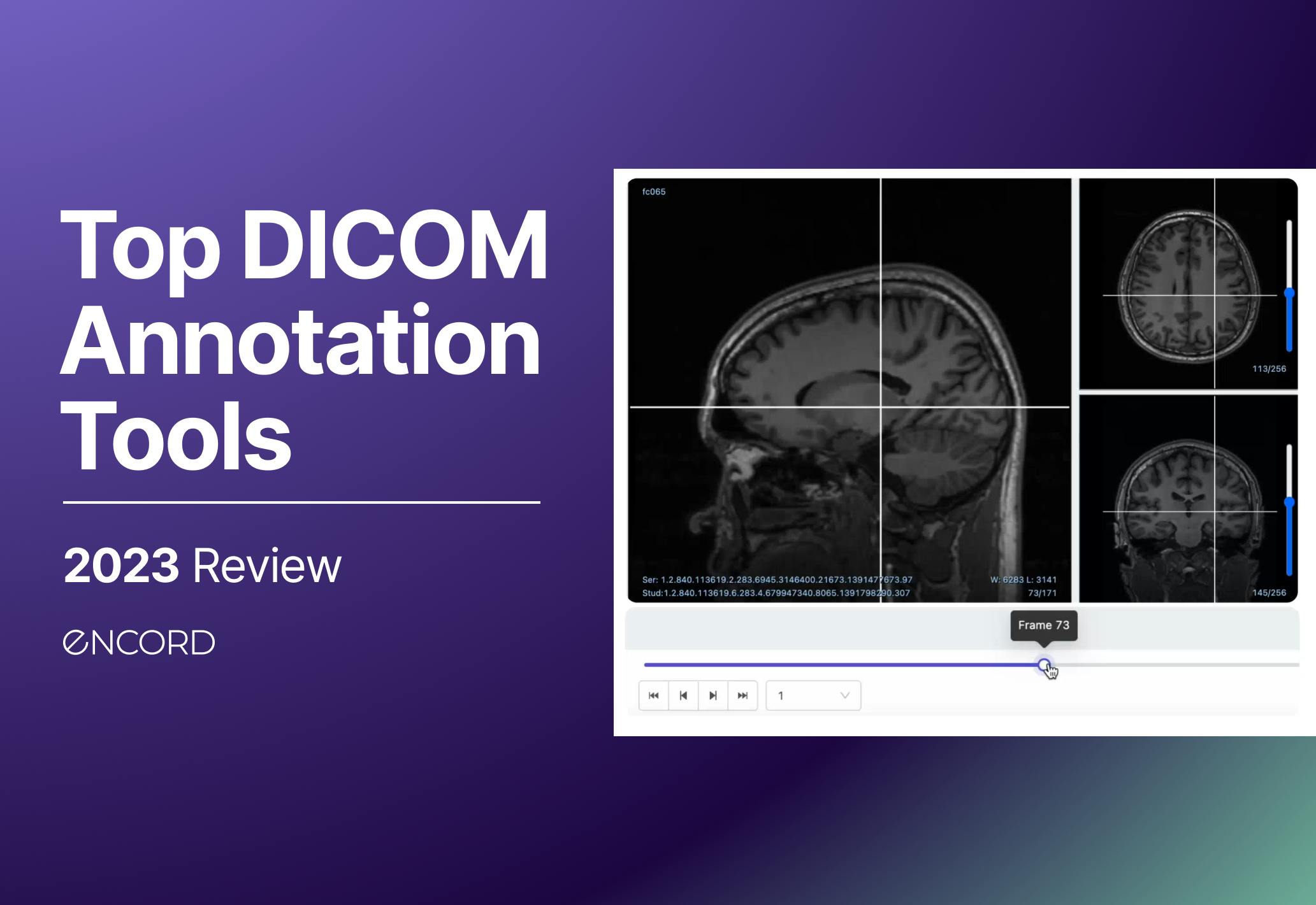 What is the difference Between DICOM and NIfTI medical image files ...